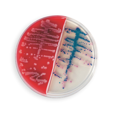CHROMAGAR O157 C/10 – RYT Labs